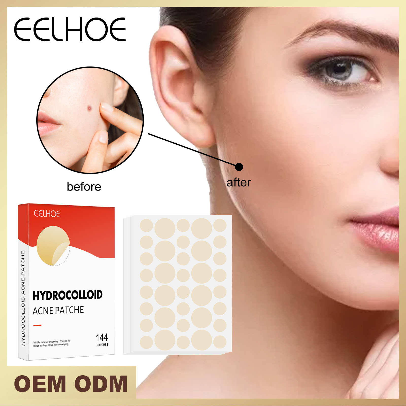 Wholesale eelhoe hydrocolloid acne patch invisible makeup closed mouth ...